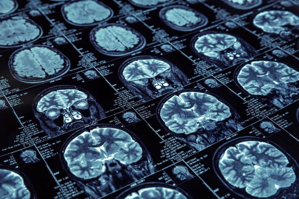 EMI Shielding For MRI Equipment | XGR Technologies